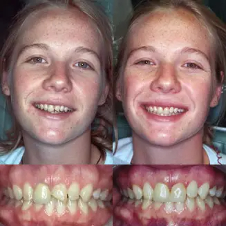 Smile Gallery in Playa Del Rey, CA | For Gentle Dental Care